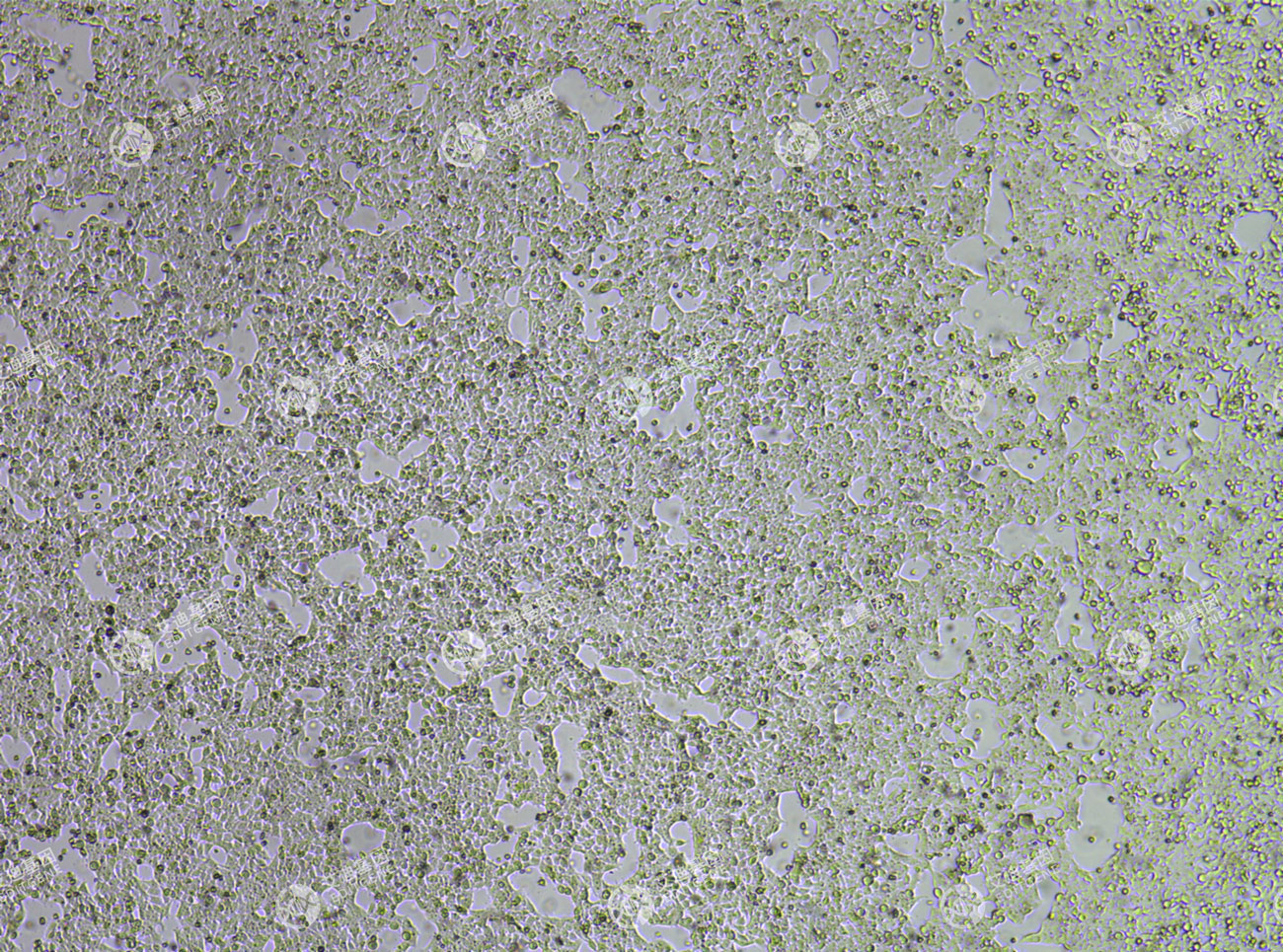 CAL-33-FLUC 细胞系公司| CAL-33 Luc 细胞系价格 | Luciferase 细胞系 – 艾迪基因